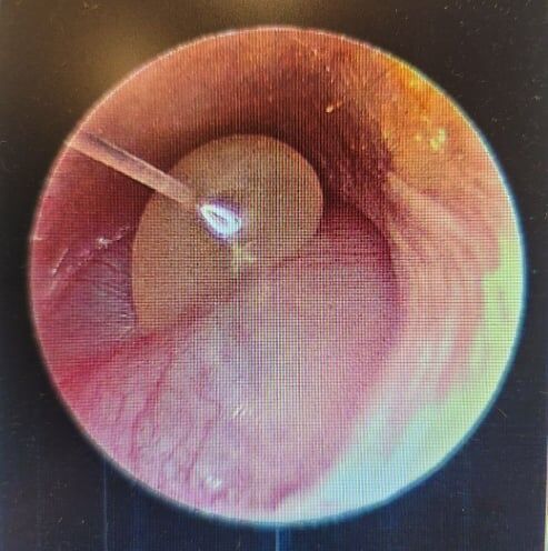 Grommets And The Benefits of Using Them